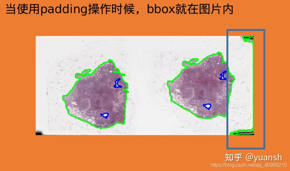 CLAM: A Deep-Learning-based Pipeline for Data Efficient and Weakly Supervised Whole-Slide-level ...