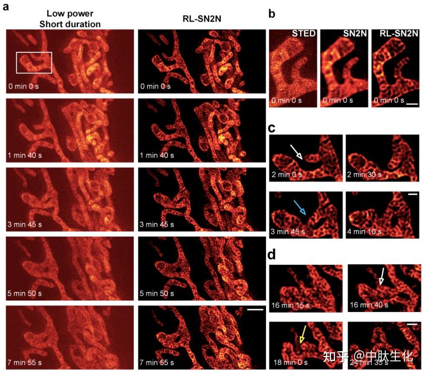 Nat Methods：赵唯淞/李浩宇/陈良怡合作发明SN2N自启发去噪方法，实现快速、温和的长时程超分辨成像 四色活细胞超分辨成像 - 知乎