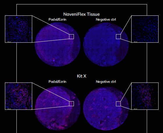 小优进修班∣Naveni® PLA产品效果展示 - 知乎