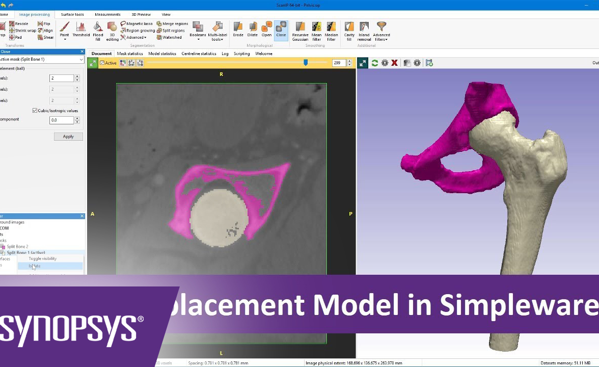 【Simpleware】三维图像处理和模型生成的专业平台 - 知乎
