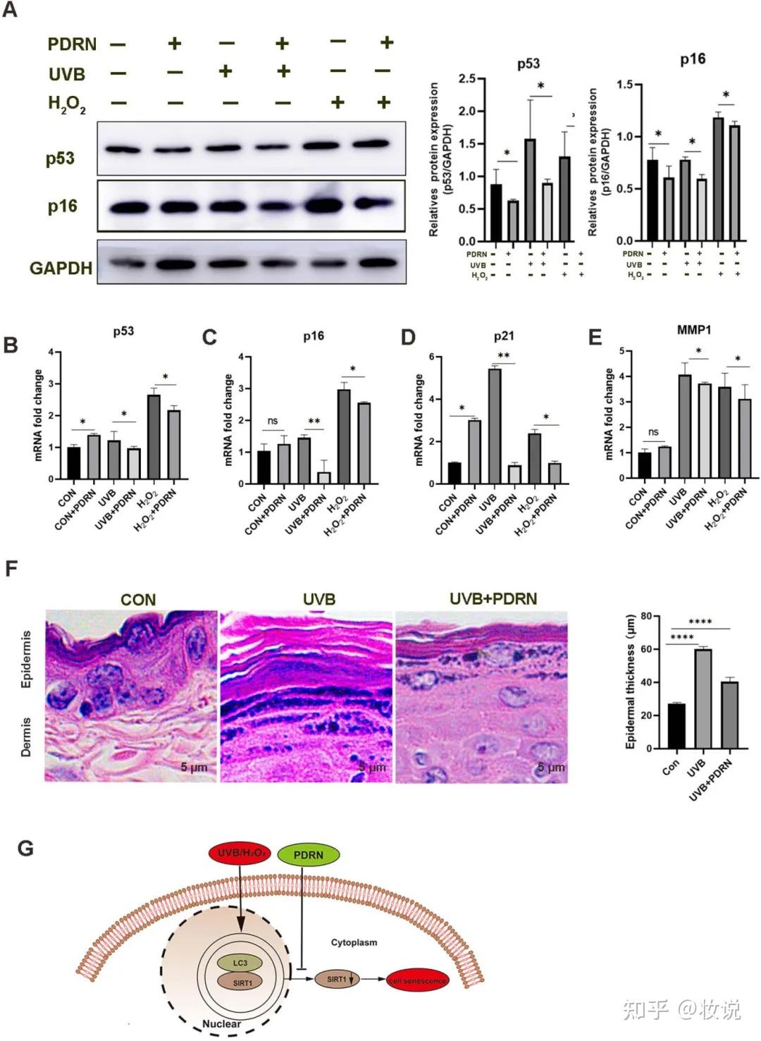 新发现！PDRN通过减弱自噬阻止“长寿蛋白”降解延缓衰老 - 知乎