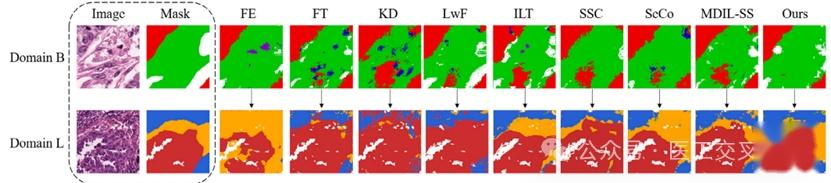 江南大学人工智能与计算机学院潘祥副教授团队提出用于病理图像分割的域增量弱监督状态空间模型DIPathMamba - 知乎