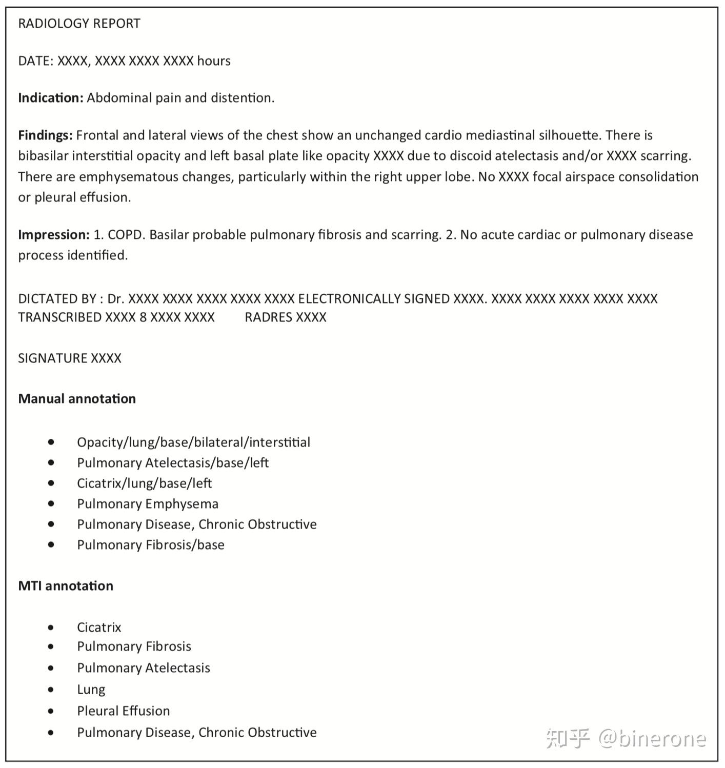 【IU-XRay】医疗诊断报告生成数据集 - 知乎