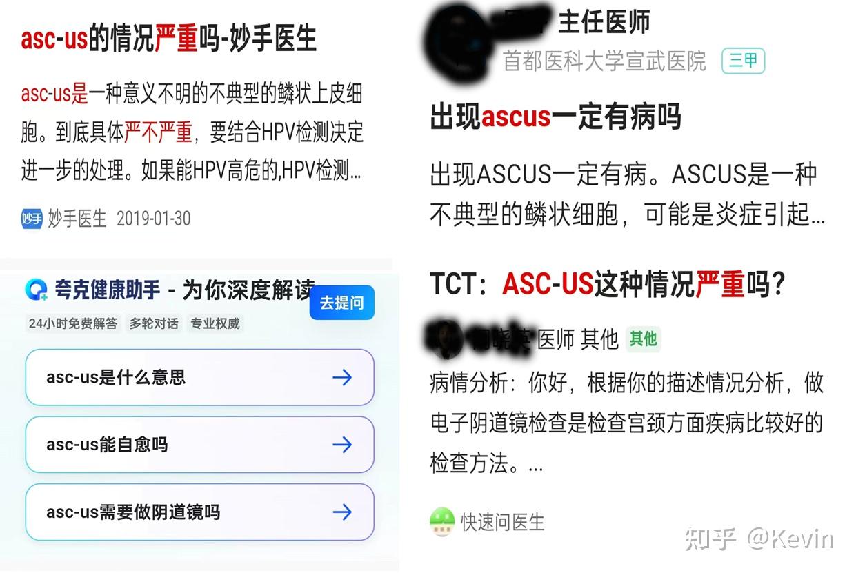 非医师普通患者如何解读宫颈癌筛查ASC-US报告 - 知乎