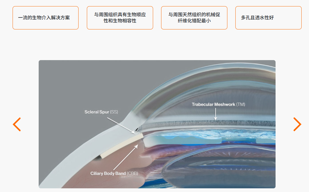 Iantrek 已完成 2,000 例新生物介入技术 AlloFlo Uveo治疗青光眼手术 - 知乎
