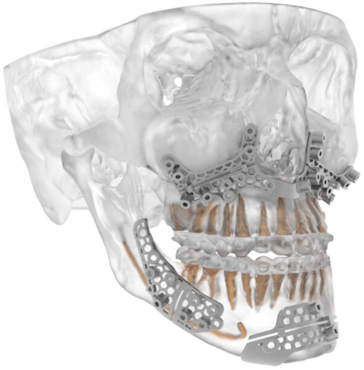 3D Systems 重磅推出 QuickCast Air™ 高精度熔模铸造产品组合迎来新成员 - 知乎