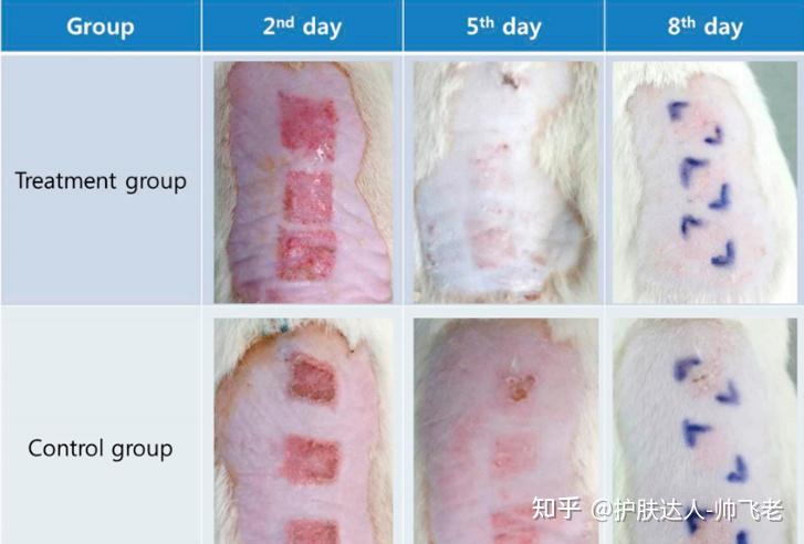 PDRN是什么？ - 知乎