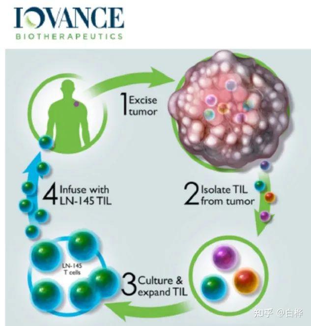 国内首例TIL疗法治疗宫颈癌实现临床完全缓解，无病生存已超8周 - 知乎