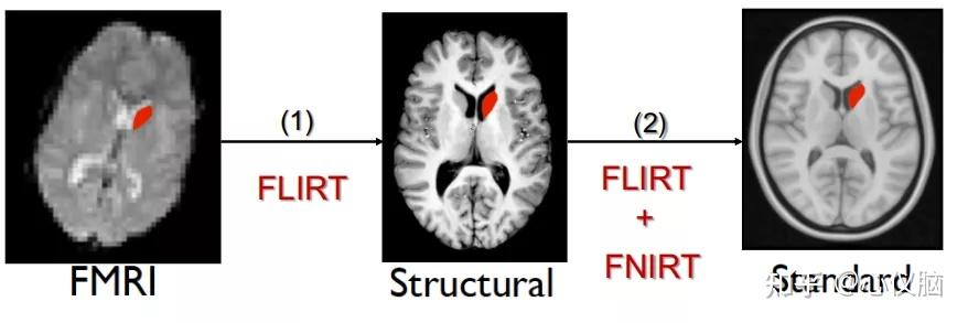 利用FSL进行核磁数据处理(使用GUI/代码) - 知乎