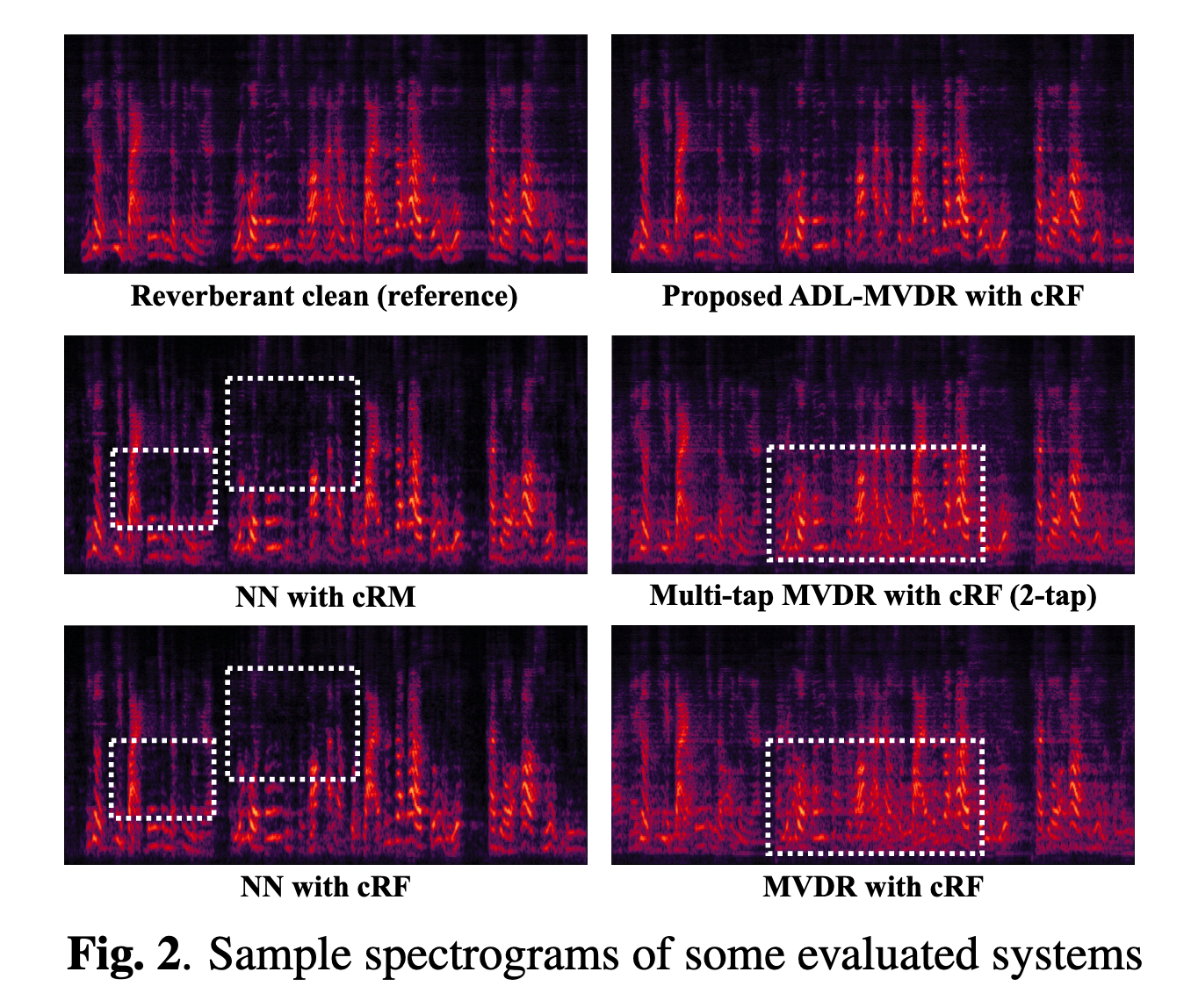 ADL-MVDR: All deep learning MVDR beamformer for target speech ...