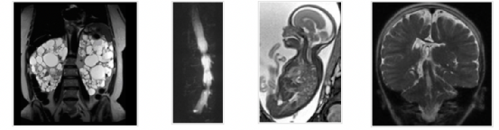 HASTE/SS-FSE，超快速成像 - 知乎