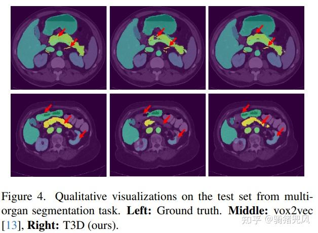 T3D——新一代三维医学图像理解框架 - 知乎