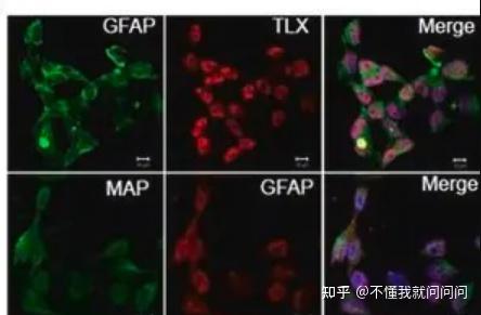 默克生命科学干货 | 单克隆抗 MAP2 (2a + 2b) 小鼠抗 - 知乎