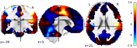 Nilearn：基于Python语言神经成像的机器学习（7） - 知乎