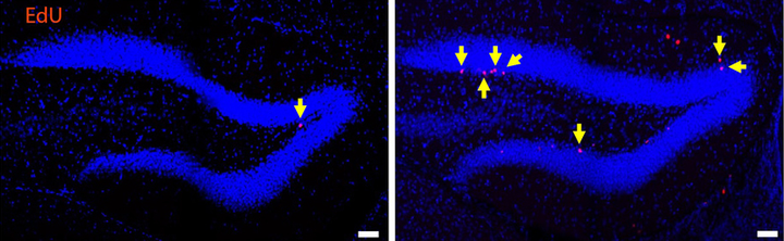 MIT团队利用40Hz声光刺激改善唐氏综合征小鼠认知功能，人类实验已开始 - 知乎