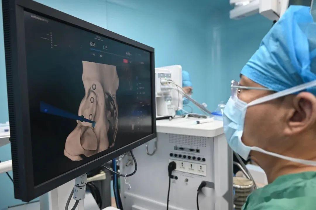 井陉县医院：首例！机器人辅助下后外侧入路（DAA）全髋关节置换术顺利完成！ - 知乎