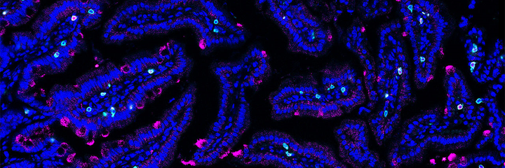 Sci Immun | 揭示T细胞谱系选择的关键转录因子 - 知乎