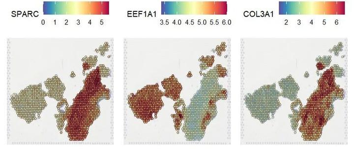 空间转录组|Load10X_Spatial函数修改适配多形式数据 + 空转标准流程 - 知乎
