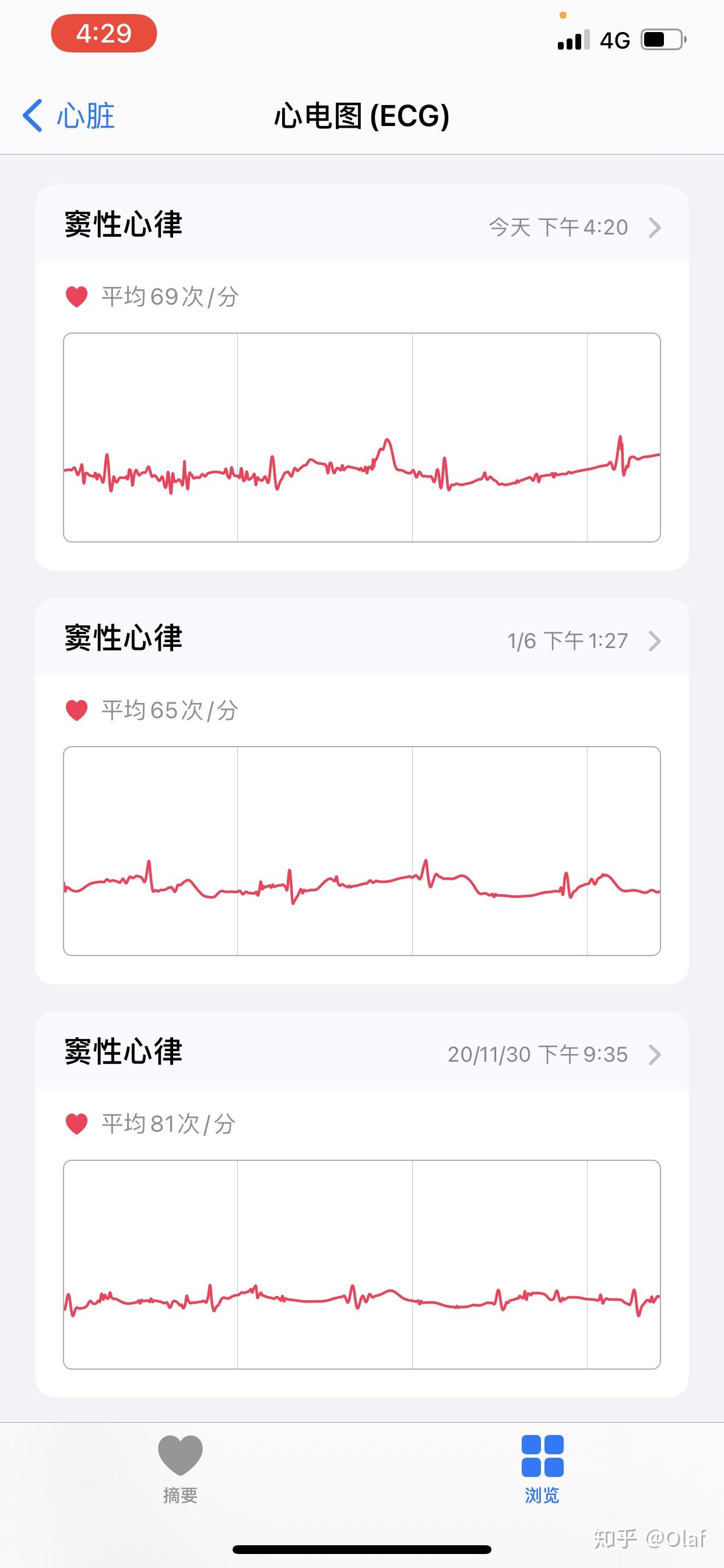 2023年Apple Watch心电图（ECG）功能介绍和激活指南 | 看这一篇了解ECG的所有 - 知乎