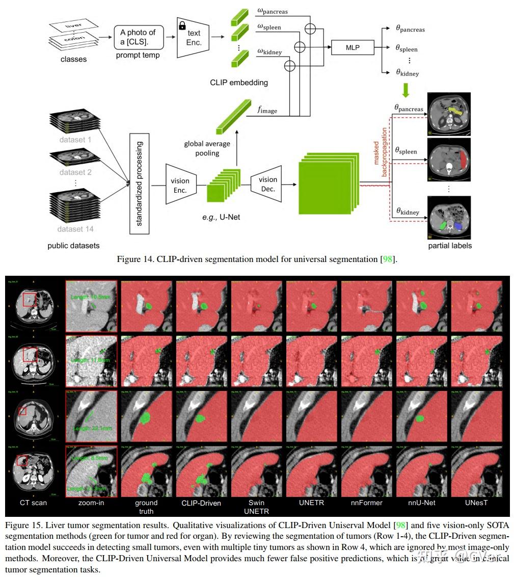 沈定刚团队新作：首篇医学领域中的CLIP技术综述 - 知乎
