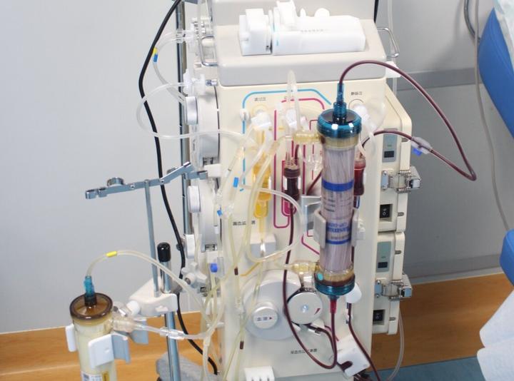 连续性血液净化技术（CBP)的进步 - 知乎