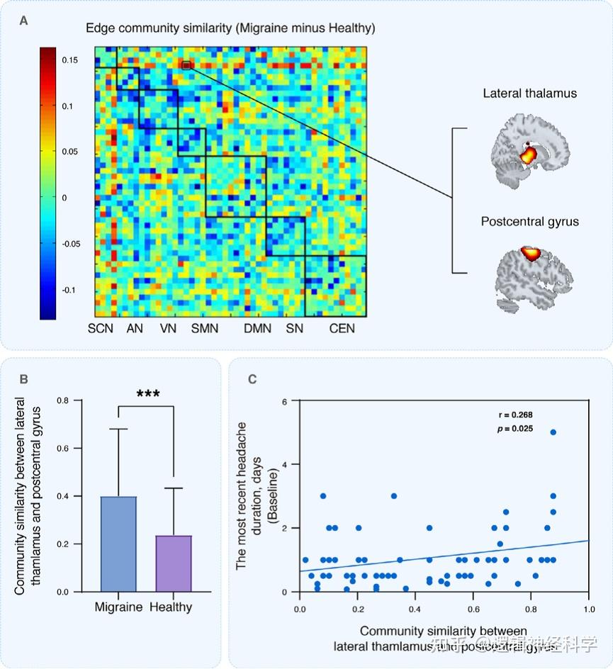Ann Neurol︱解放军总医院于生元/董钊团队揭示偏头痛重叠连边社区的丘脑-皮层异常交互模式 - 知乎