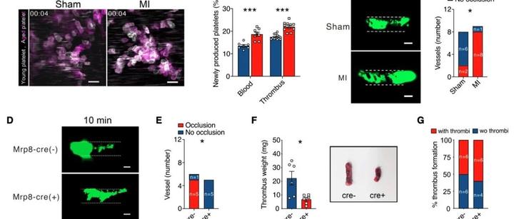 Immunity丨中性粒细胞“plucking”驱动血小板生成并促进心血管疾病 - 知乎