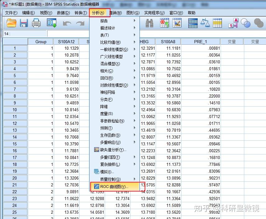 如何用SPSS做ROC曲线，检测预测模型的准确性 - 知乎