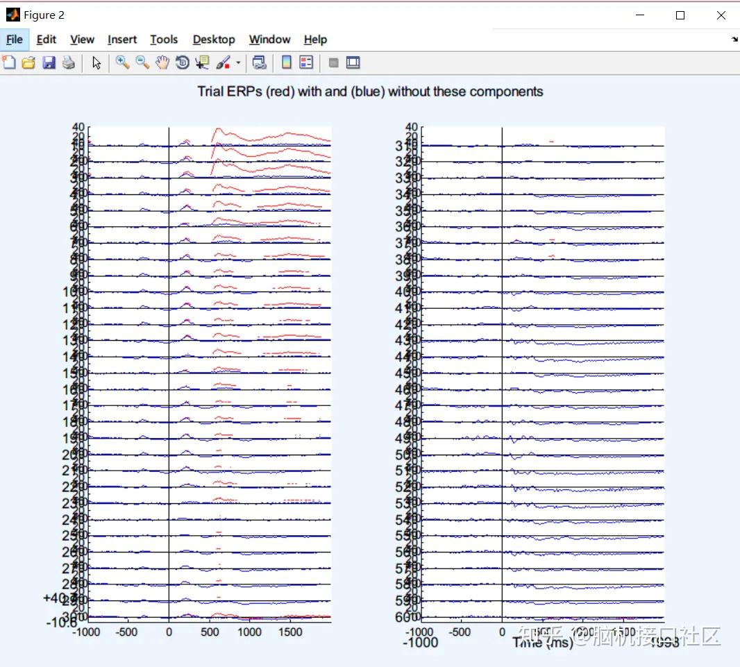 手把手教你EEG脑电数据预处理-操作篇 - 知乎