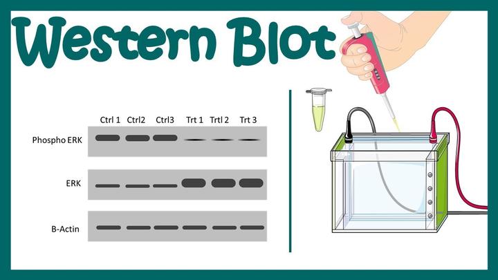 【实验技术学习笔记】Western Blot - 知乎