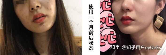 BEOE真是YYDS - 知乎