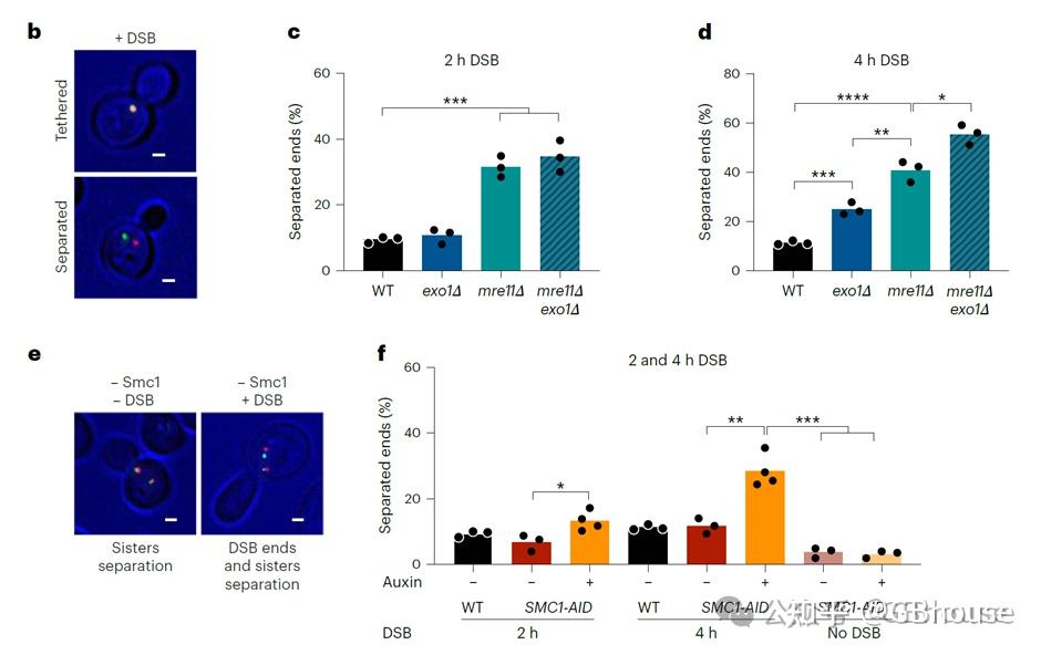 NCB|看Cohesin如何介导DNA双链断裂末端连接 - 知乎