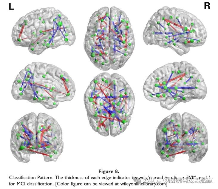 Hum Brain Mapp：基于连接强度加权稀疏群表示的脑网络构建新方法可用于轻度认知障碍分类 - 知乎