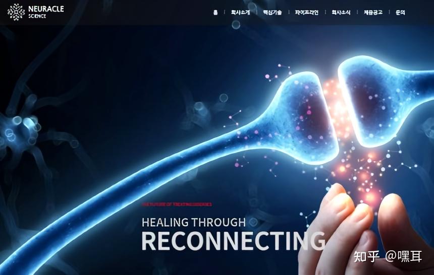 治疗听力损失的新药NS101正在招募对象进入临床试验 - 知乎