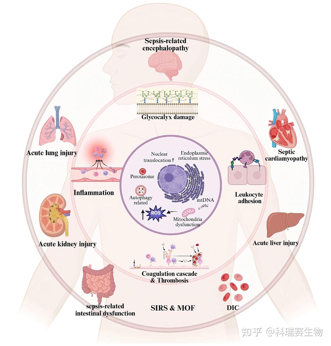 Nature子刊 | 血管“守护者”的悲歌：内皮细胞程序性死亡如何引爆脓毒症风暴 - 知乎