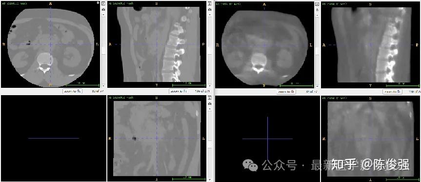 SynthRAD2025——用于放射治疗的计算机断层扫描生成挑战赛 - 知乎