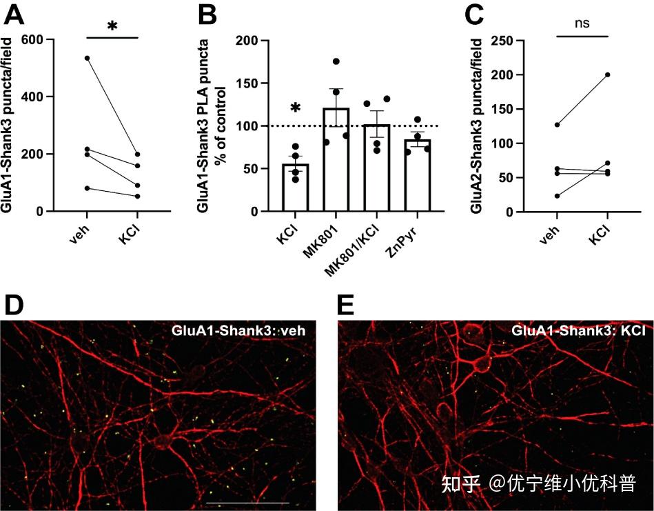 小优读文献∣Naveni® PLA技术&现有文献部分解析 - 知乎