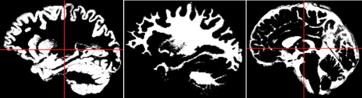 part4 rest计算reho、alff、falff - 知乎