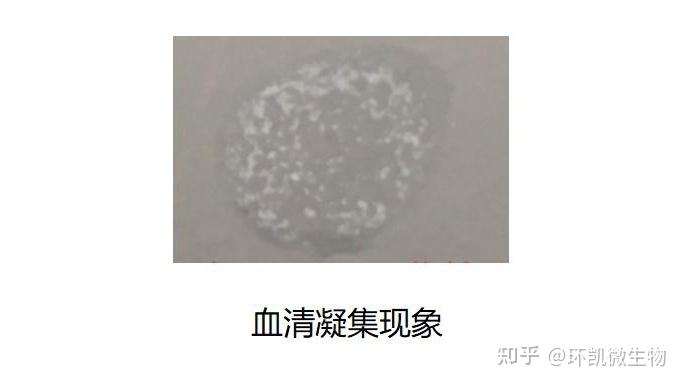 GB4789-6-2016 致泻大肠埃希氏菌检验及注意事项 - 知乎