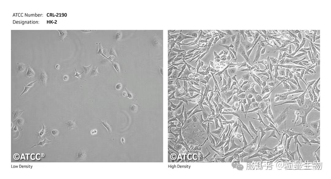 一叶知秋 | HK-2细胞基因编辑全攻略：从背景到实践的全面解析 - 知乎