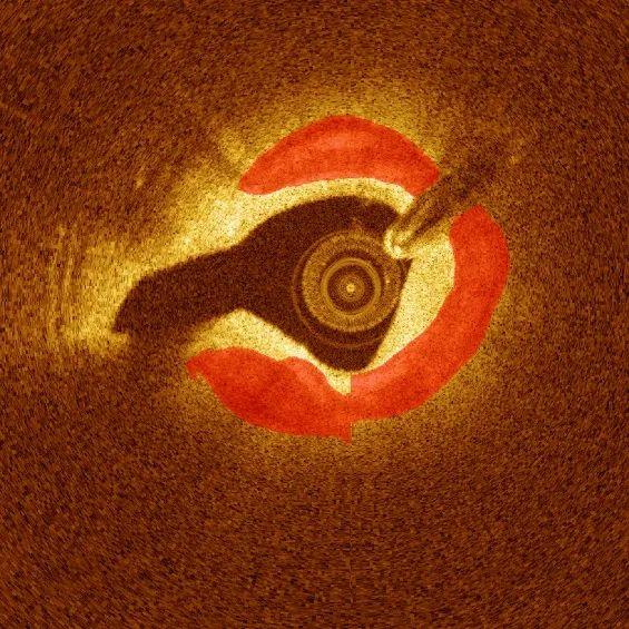 CCEC·前沿技术｜当人工智能“预见”OCT - 知乎