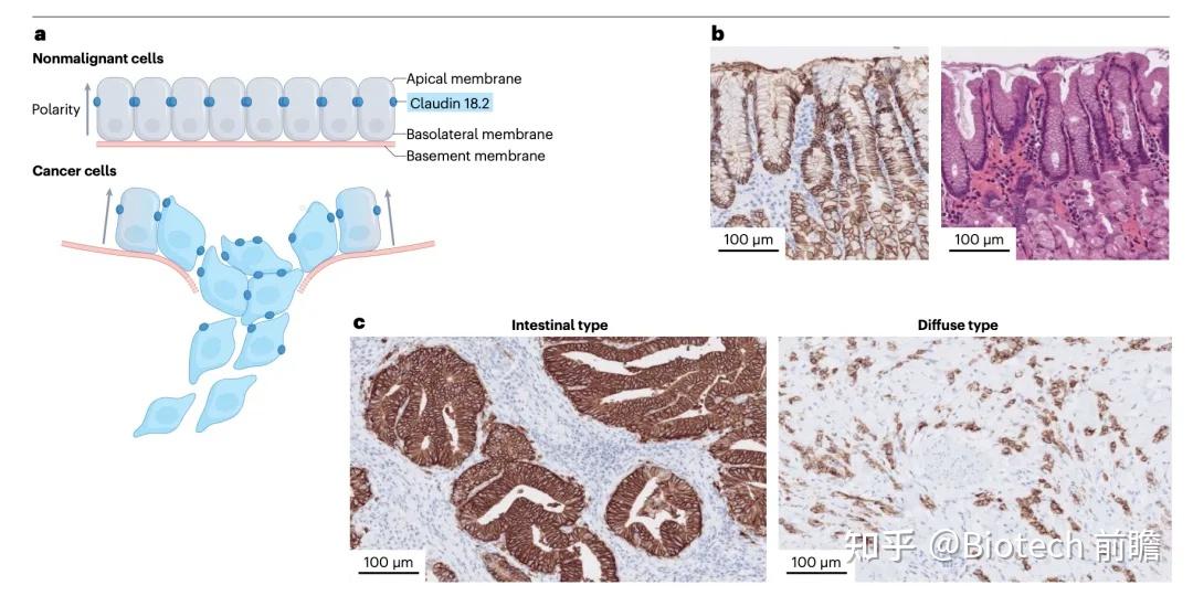 自然子刊丨治疗新靶点CLDN18.2综述 - 知乎