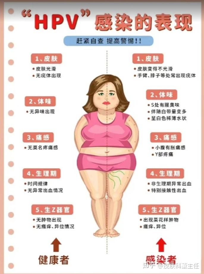 身体长小凸起就是hpv？自查小知识轻松辨别 知乎 5801