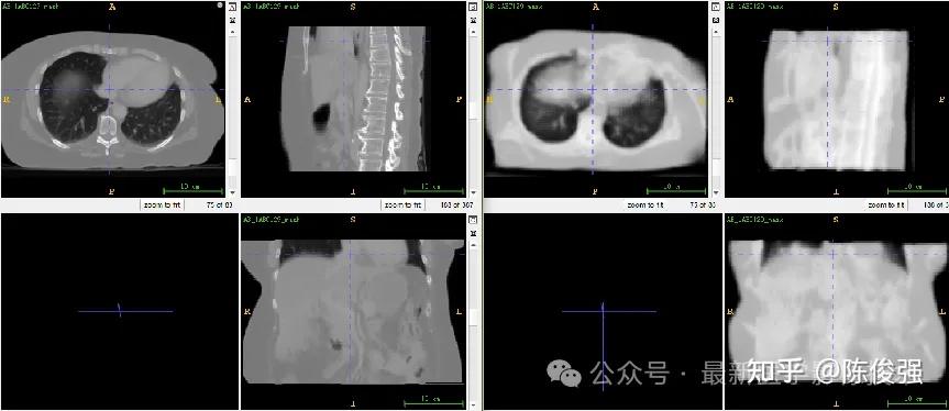 SynthRAD2025——用于放射治疗的计算机断层扫描生成挑战赛 - 知乎