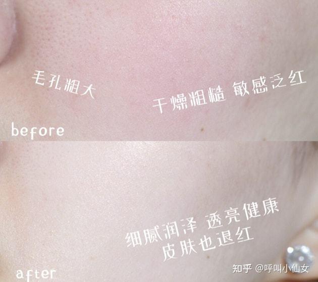 2026大牌测评！赫莲娜护肤品怎么样？HR赫莲娜黑绷带面霜和白绷带面霜，有什么区别？赫莲娜黑白绷带/绿宝瓶精华液新肌水乳液洁面哪个好用？与海蓝 ...