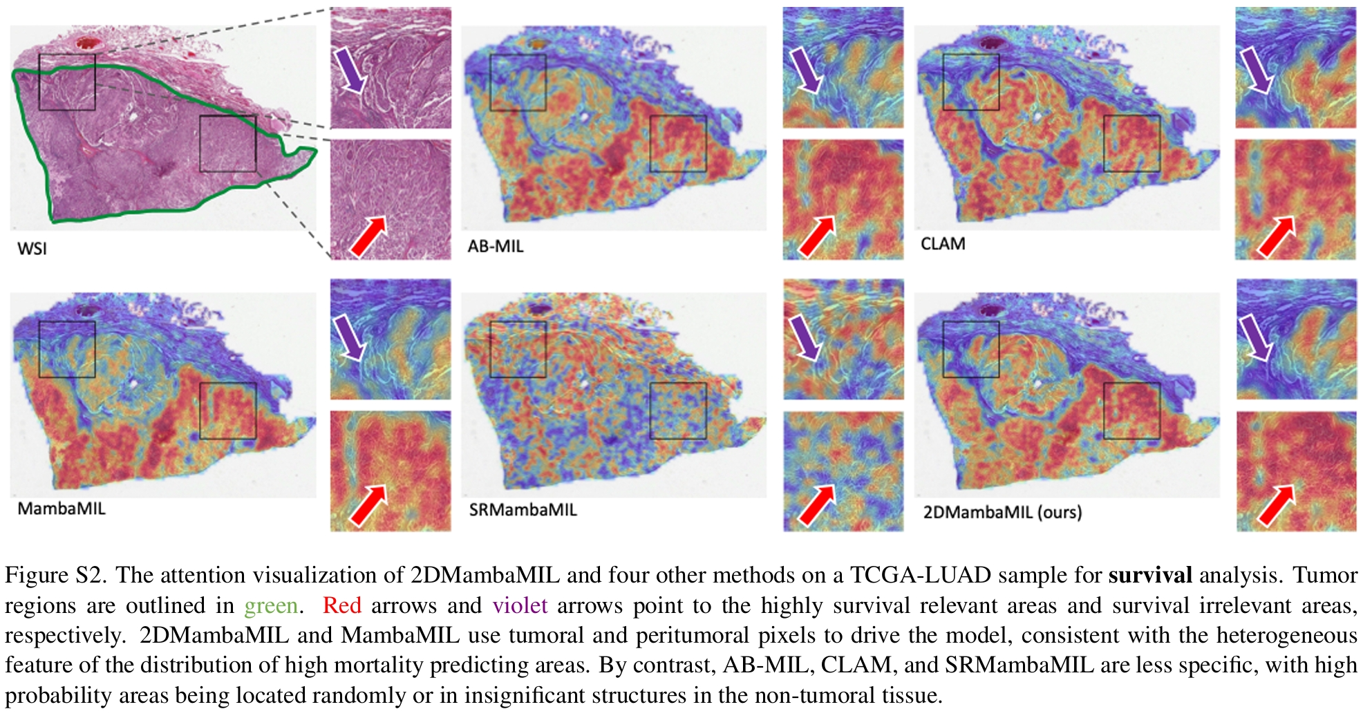 【CVPR 2025】2DMamba：高效状态空间模型在图像表示中的应用——以千兆像素全切片图像分类为例（2DMamba） - 知乎