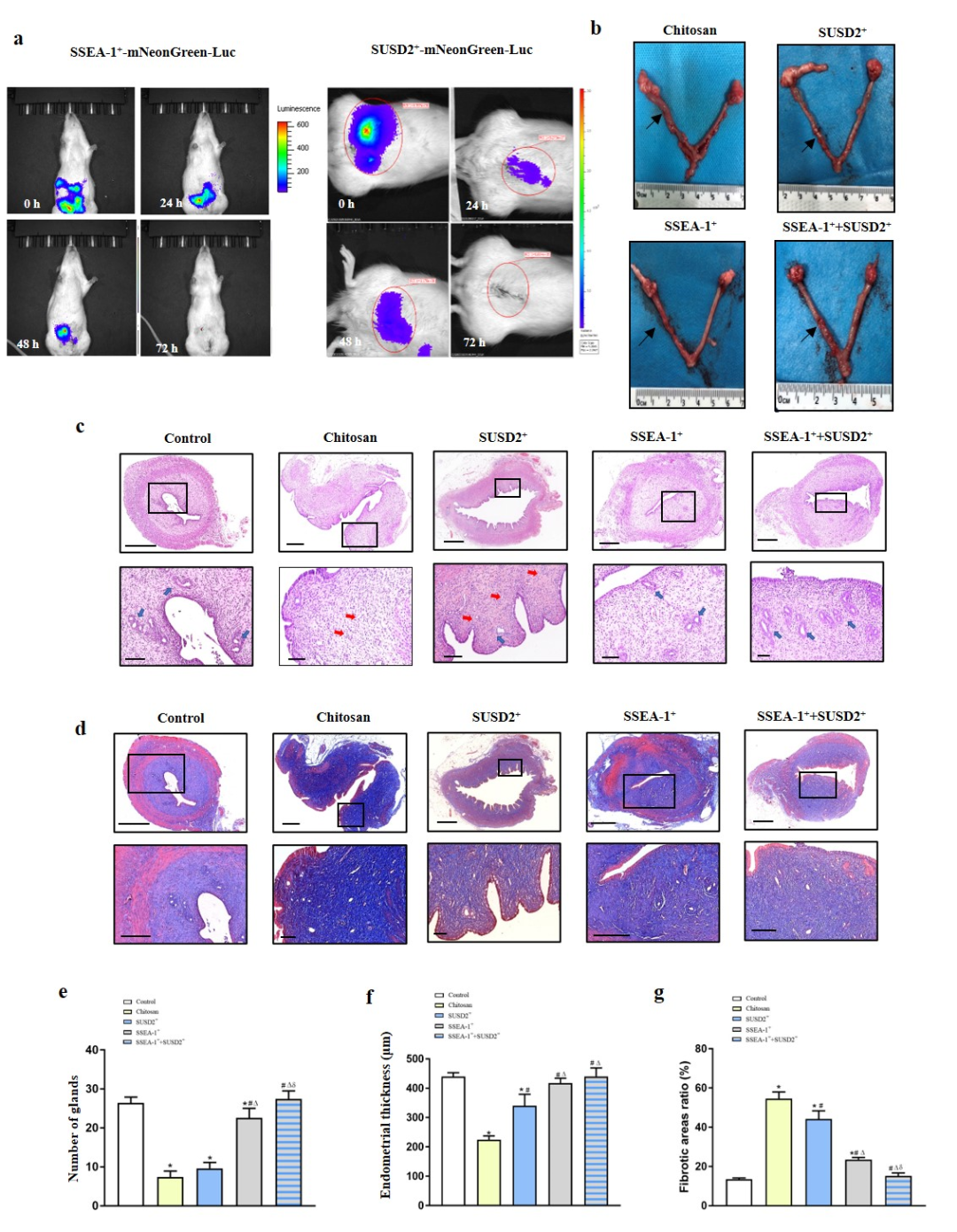 Cell Biosci︱孙晓溪团队/赛立维生物合作建立人子宫内膜上皮干细胞体外培养系统及探索其对IUA的治疗潜能 - 知乎