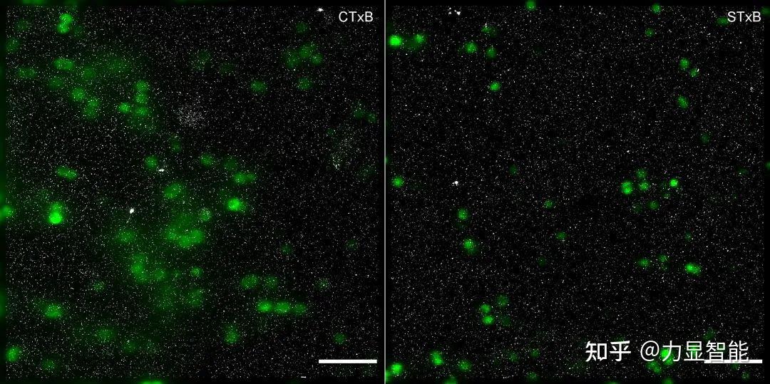 什么是随机光学重建显微镜STORM? - 知乎