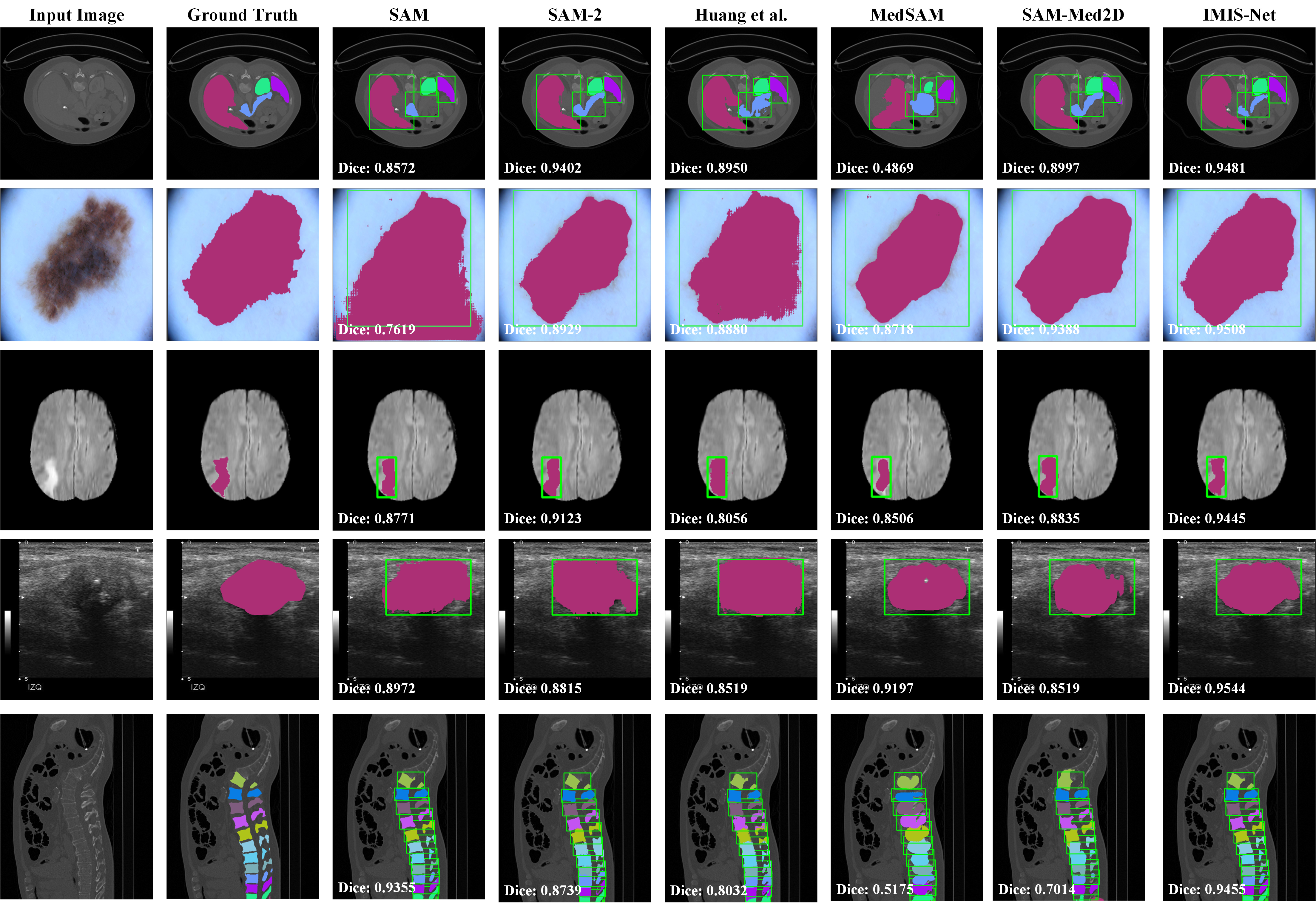 IMIS-Bench：3.61 亿个掩码！开创性交互式医学图像分割基准数据集IMed-361M，重磅发布！ - 知乎