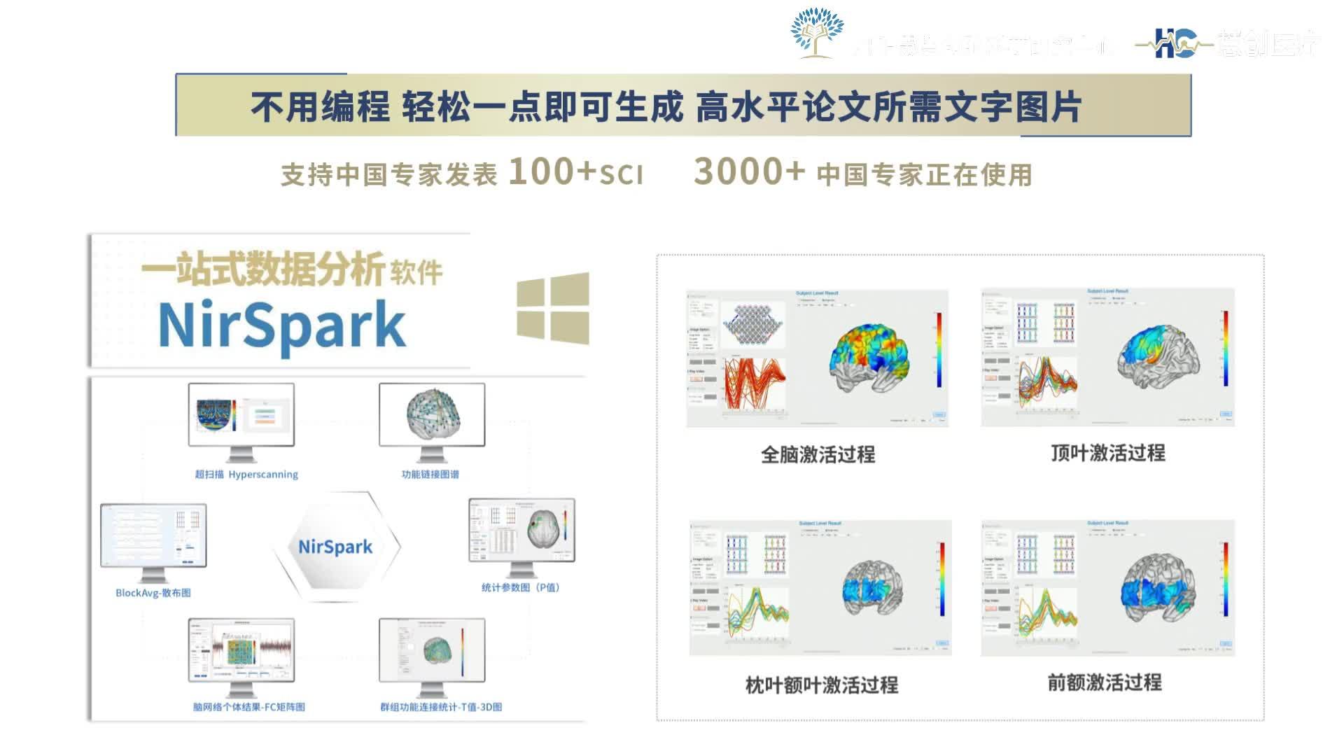 北航汪待发团队fNIRS运动伪影检测方法被评最佳 来自意大利热那亚大学发表于Neurophotonics的一项研究 - 知乎